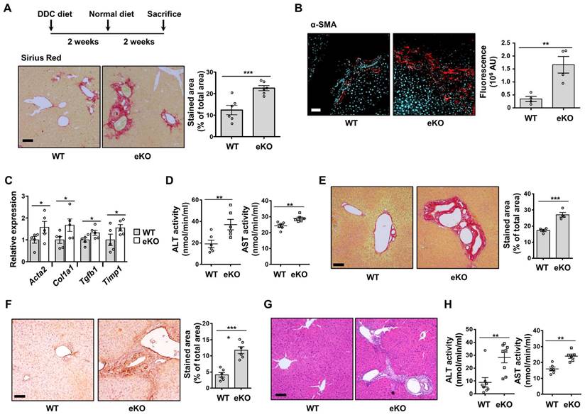 Endothelial TAZ inhibits capillarization of liver sinusoidal ...