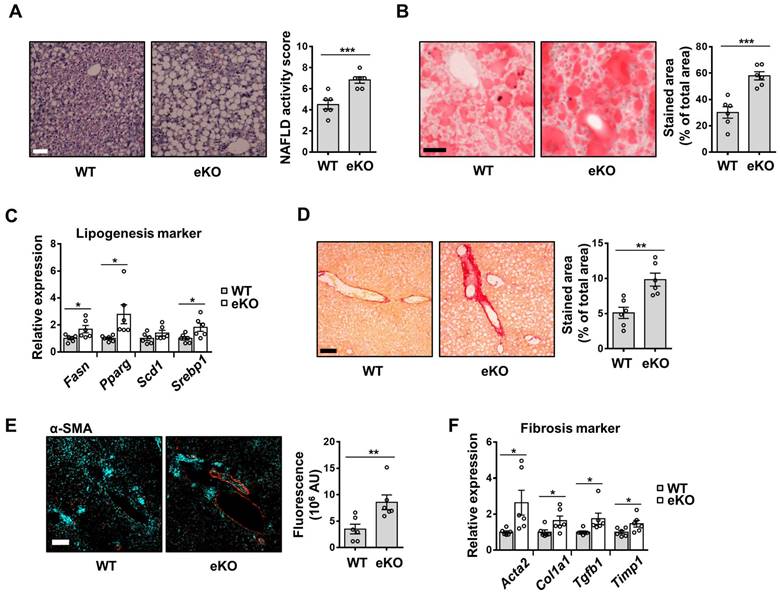 Endothelial TAZ inhibits capillarization of liver sinusoidal ...