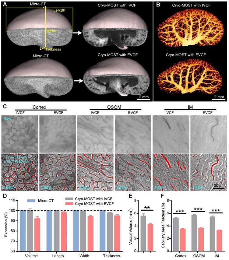 3D autofluorescence imaging of hydronephrosis and renal anatomical ...