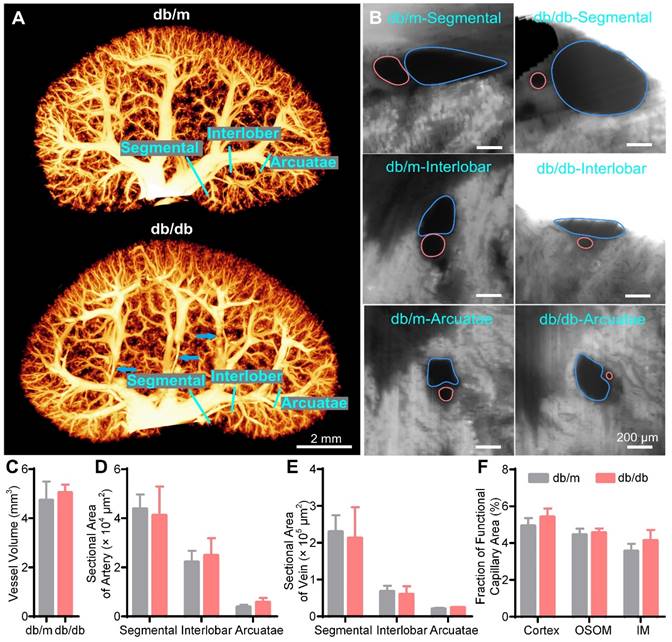 3D autofluorescence imaging of hydronephrosis and renal anatomical ...