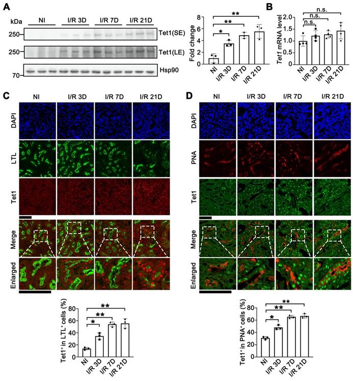 Tet1 deficiency exacerbates oxidative stress in acute kidney injury by ...