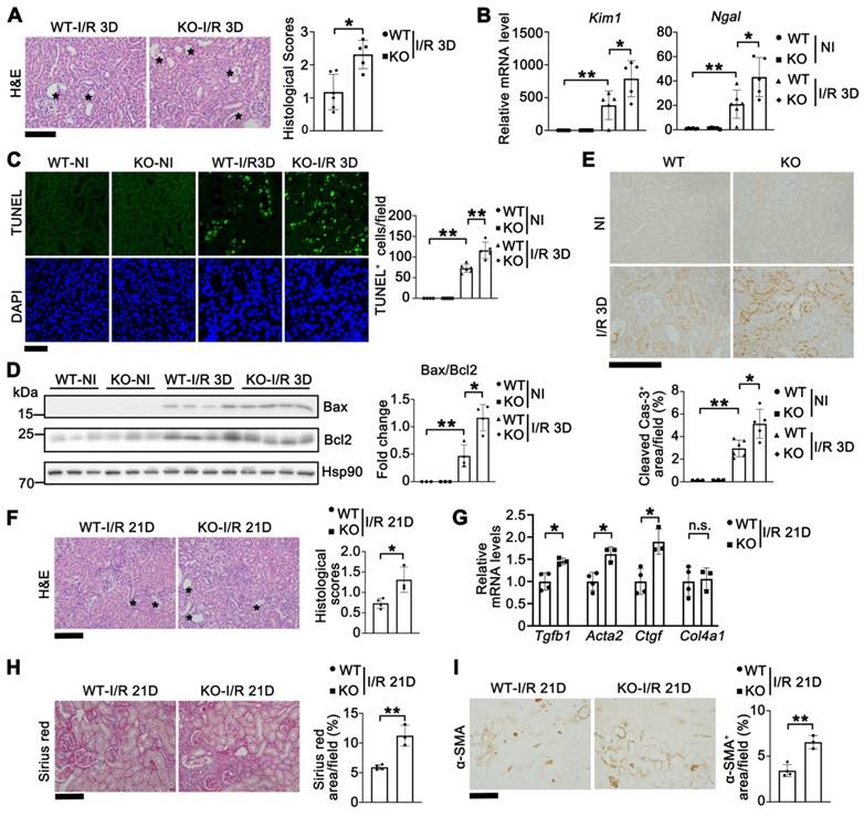 Tet1 deficiency exacerbates oxidative stress in acute kidney injury by ...