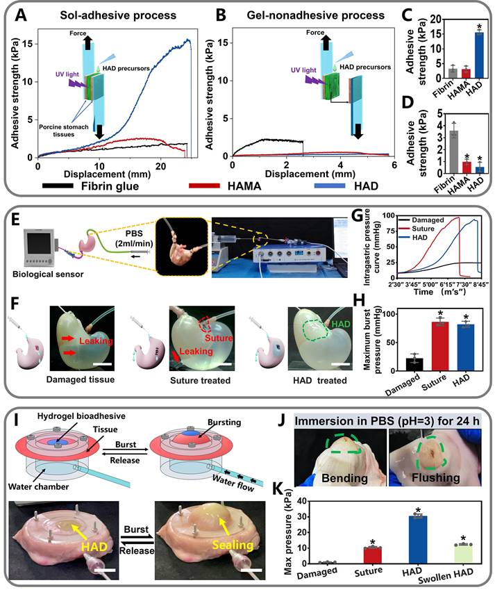 Photocurable injectable Janus hydrogel with minimally invasive delivery ...