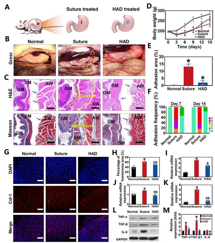 Photocurable injectable Janus hydrogel with minimally invasive delivery ...