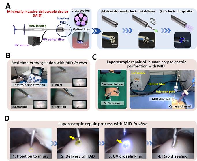 Photocurable injectable Janus hydrogel with minimally invasive delivery ...