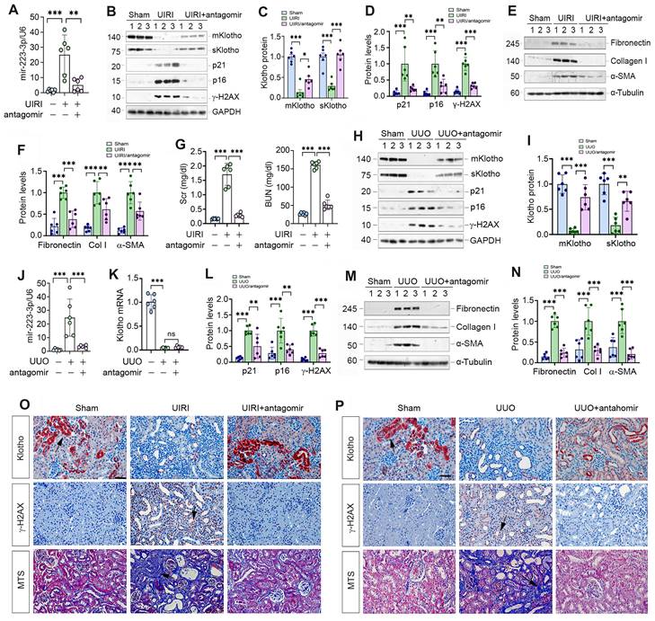 Klotho-derived peptide 1 inhibits cellular senescence in the fibrotic ...