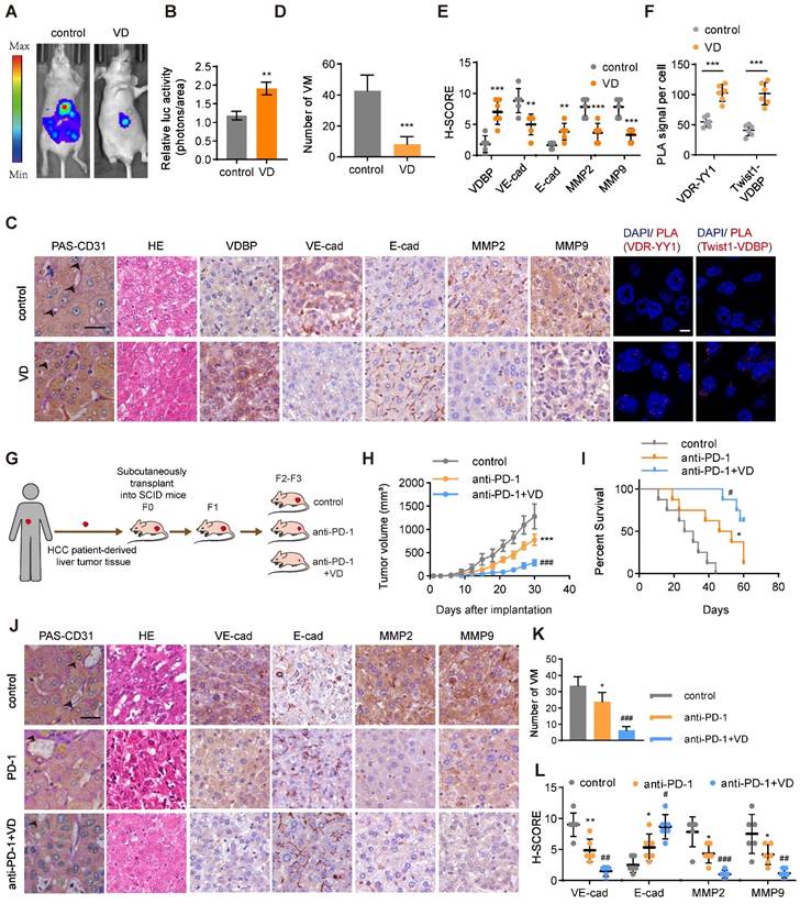 Vitamin D binding protein (VDBP) hijacks twist1 to inhibit vasculogenic ...