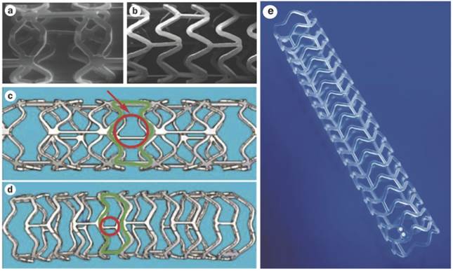 Bioabsorbable Stent Quo Vadis: A Case for Nano-Theranostics