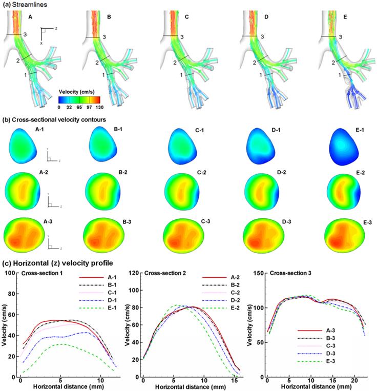 CFD Modeling and Image Analysis of Exhaled Aerosols due to a Growing ...