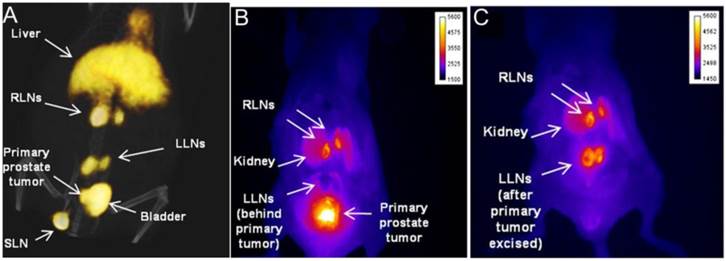 Lymphatic Imaging: Focus on Imaging Probes