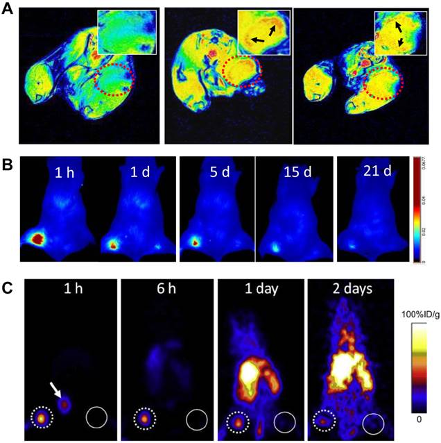 Lymphatic Imaging: Focus on Imaging Probes