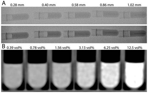 A Novel Inherently Radiopaque Bead for Transarterial Embolization to ...