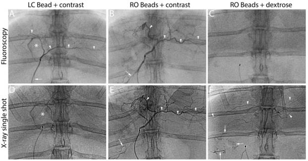 A Novel Inherently Radiopaque Bead for Transarterial Embolization to ...