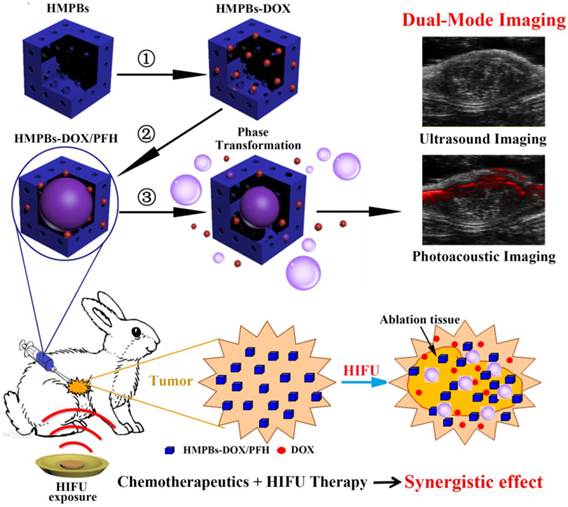 A Multifunctional Theranostic Nanoagent for Dual-Mode Image-Guided HIFU ...