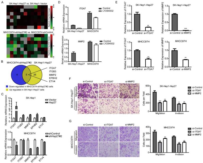 A Targetable Molecular Chaperone Hsp27 Confers Aggressiveness in ...