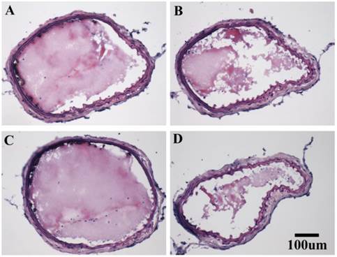 Thrombus-Targeted Theranostic Microbubbles: A New Technology towards ...