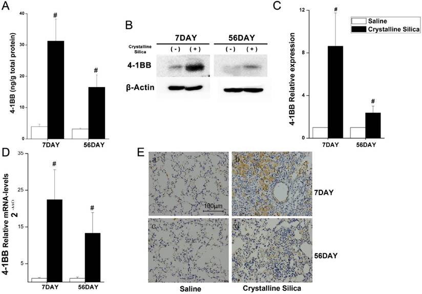 Blocking the 4-1BB Pathway Ameliorates Crystalline Silica-induced Lung ...