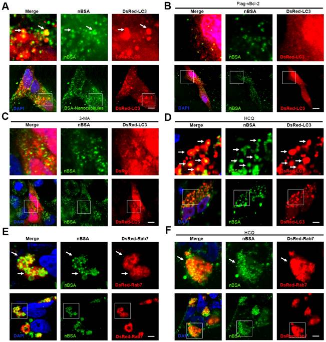 Intracellular Trafficking Network of Protein Nanocapsules: Endocytosis ...