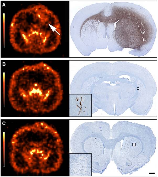 Highly Effective Auger-Electron Therapy in an Orthotopic Glioblastoma ...