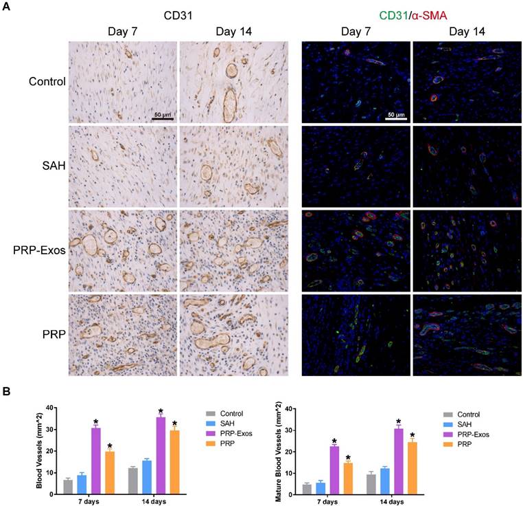 Exosomes derived from platelet-rich plasma promote the re ...