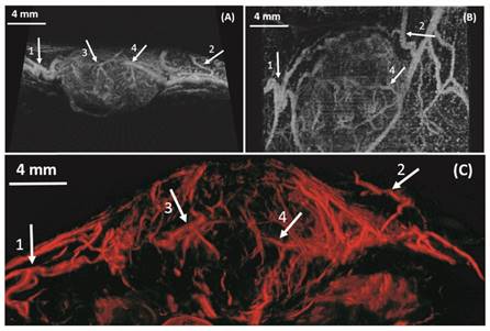 3-D Ultrasound Localization Microscopy for Identifying Microvascular ...