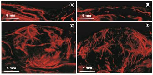 3-D Ultrasound Localization Microscopy for Identifying Microvascular ...