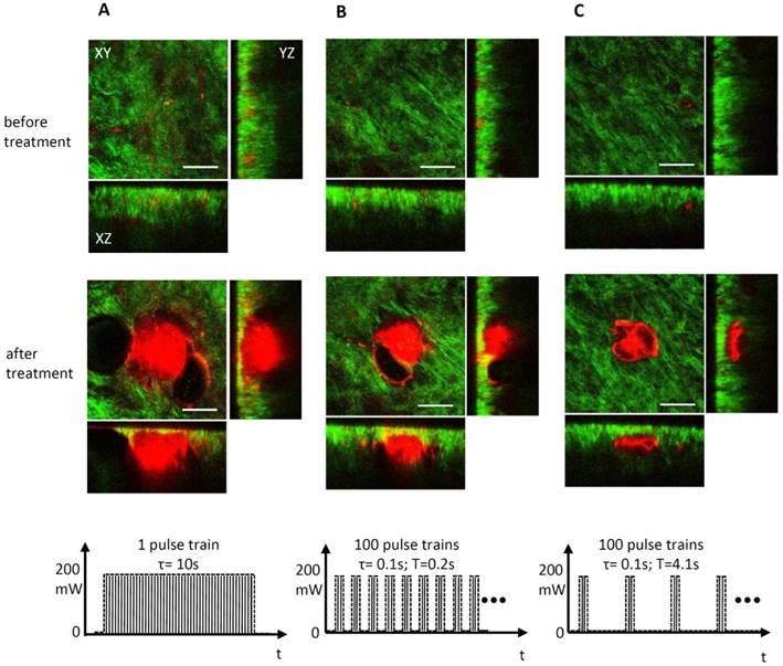Precise Spatially Selective Photothermolysis Using Modulated ...