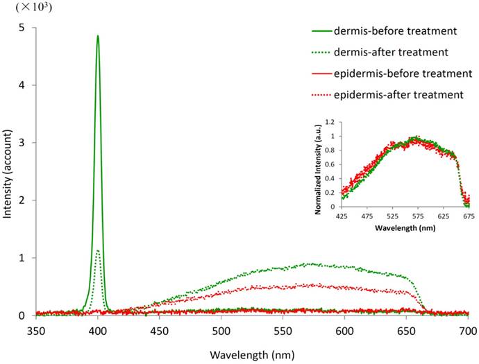 Precise Spatially Selective Photothermolysis Using Modulated ...