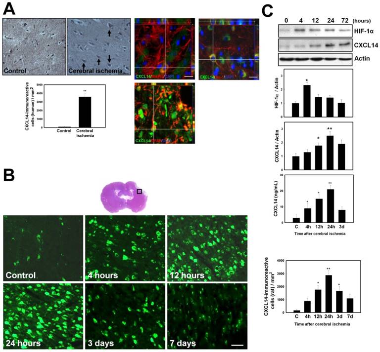 A Crucial Role of CXCL14 for Promoting Regulatory T Cells Activation in ...