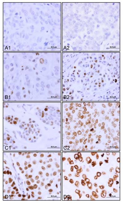 Association of γH2AX at Diagnosis with Chemotherapy Outcome in Patients ...