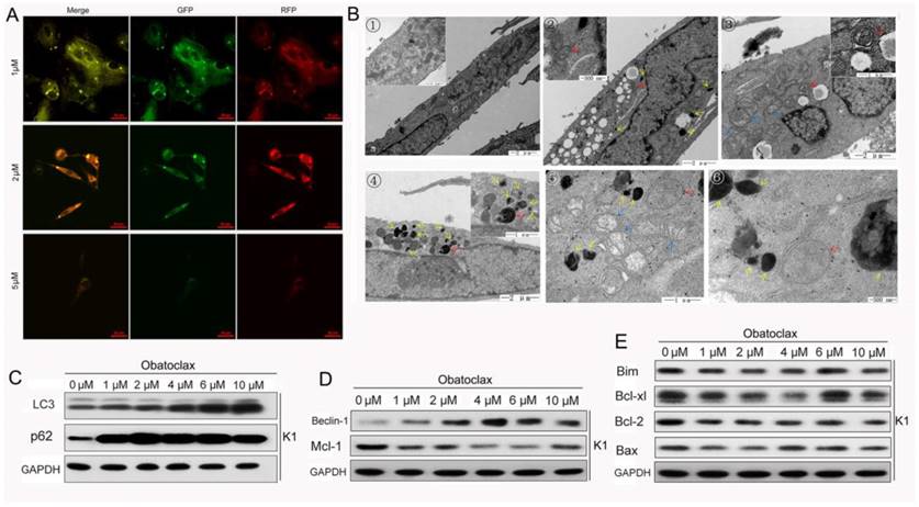 Obatoclax and LY3009120 Efficiently Overcome Vemurafenib Resistance in ...