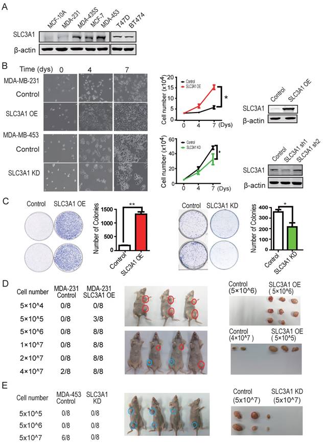 Cysteine transporter SLC3A1 promotes breast cancer tumorigenesis