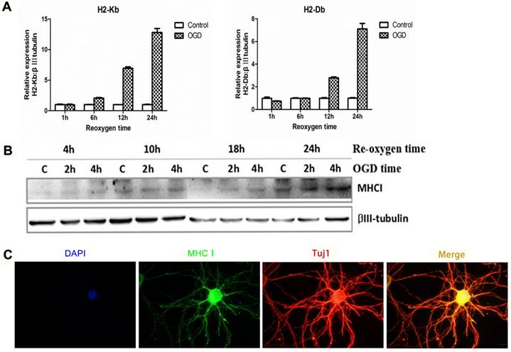 Non-Invasive Monitoring of CNS MHC-I Molecules in Ischemic Stroke Mice