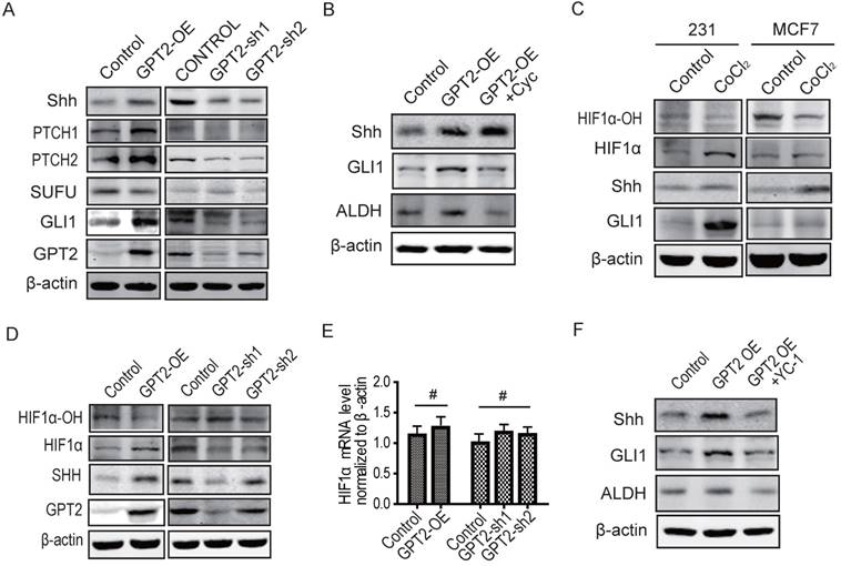 Glutamic Pyruvate Transaminase GPT2 Promotes Tumorigenesis of Breast ...