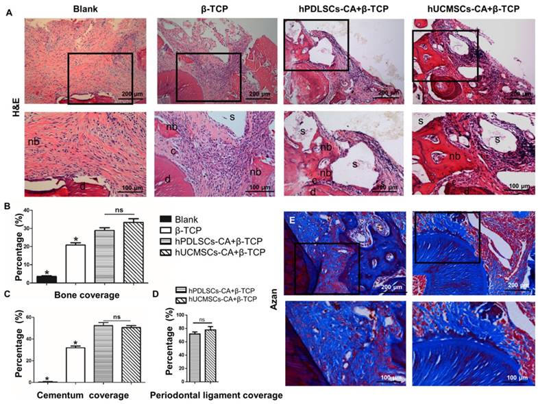 Human Umbilical Cord MSCs as New Cell Sources for Promoting Periodontal ...