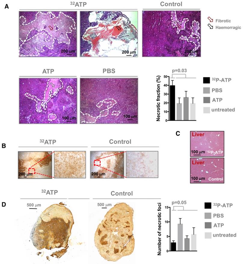 Theranostic Role of 32P-ATP as Radiopharmaceutical for the Induction of ...