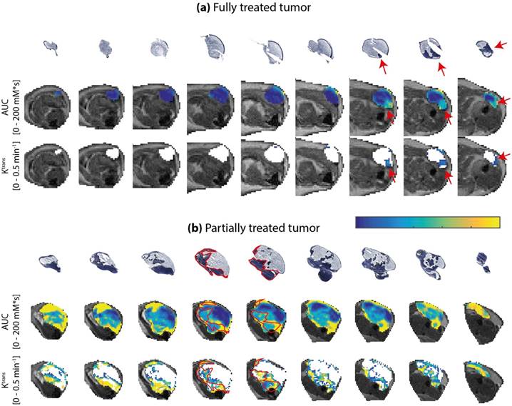 Detection of Treatment Success after Photodynamic Therapy Using Dynamic ...