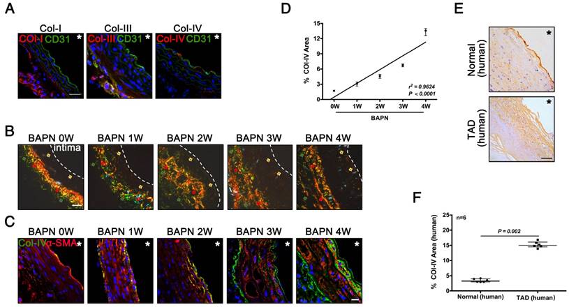 Identification of type IV collagen exposure as a molecular imaging ...