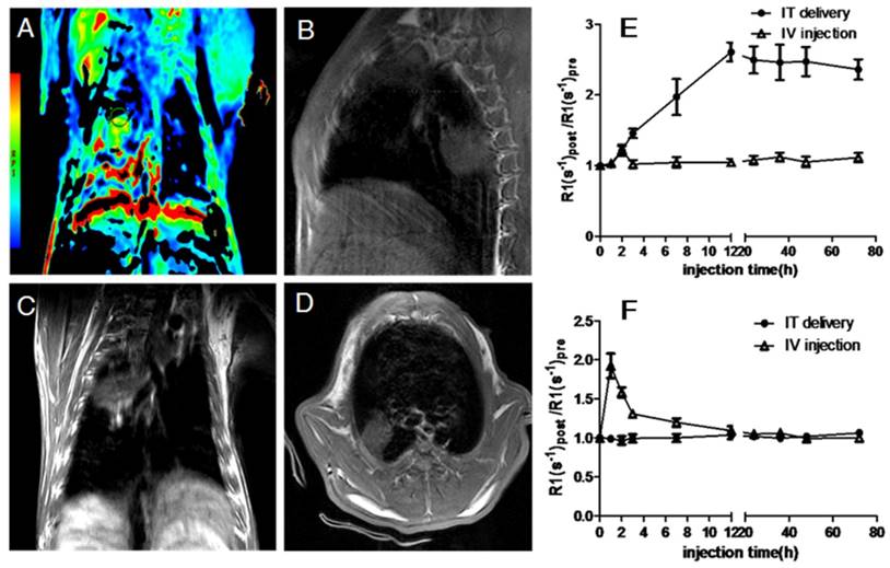 Local Intratracheal Delivery of Perfluorocarbon Nanoparticles to Lung ...