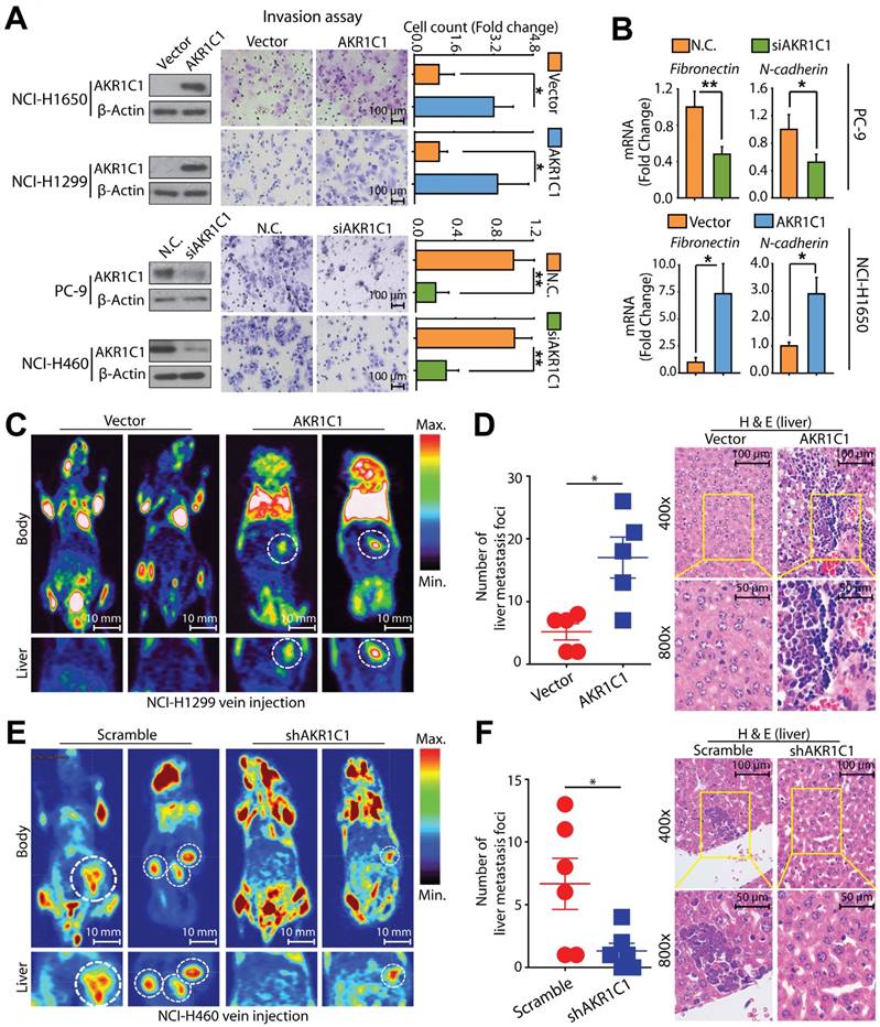 AKR1C1 Activates STAT3 to Promote the Metastasis of Non-Small Cell Lung ...