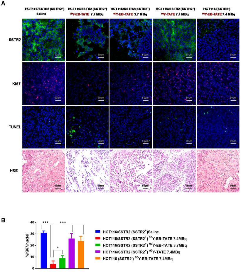 Evans Blue Attachment Enhances Somatostatin Receptor Subtype-2 Imaging ...