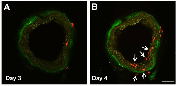Adult Stem Cells in Vascular Remodeling