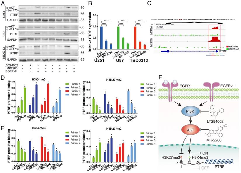 The role of PTRF/Cavin1 as a biomarker in both glioma and serum exosomes