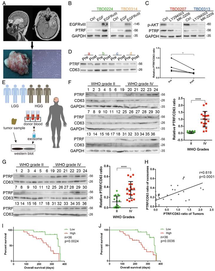 The role of PTRF/Cavin1 as a biomarker in both glioma and serum exosomes
