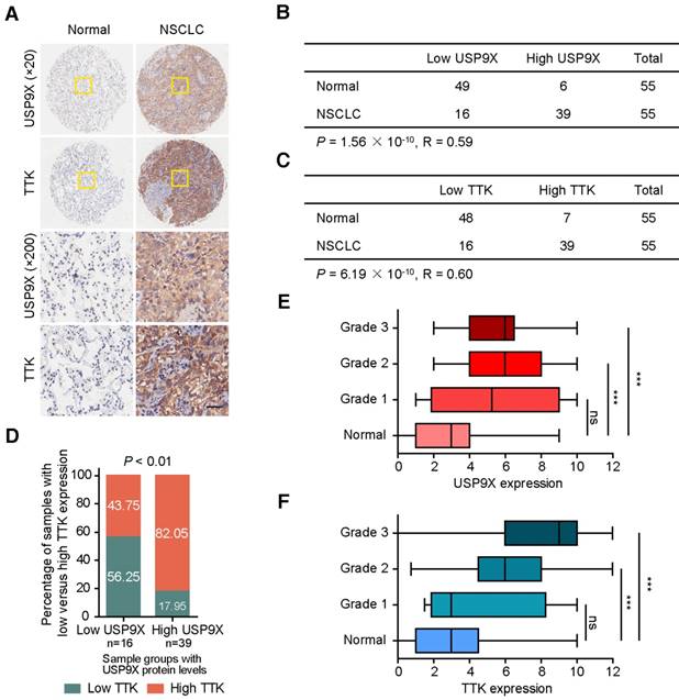 A novel USP9X substrate TTK contributes to tumorigenesis in non-small ...