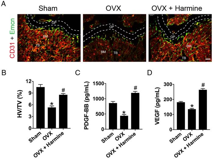 Harmine enhances type H vessel formation and prevents bone loss in ...