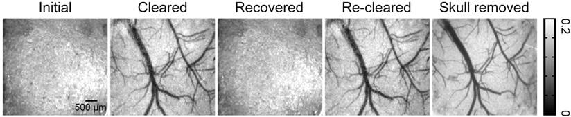 A large, switchable optical clearing skull window for cerebrovascular ...