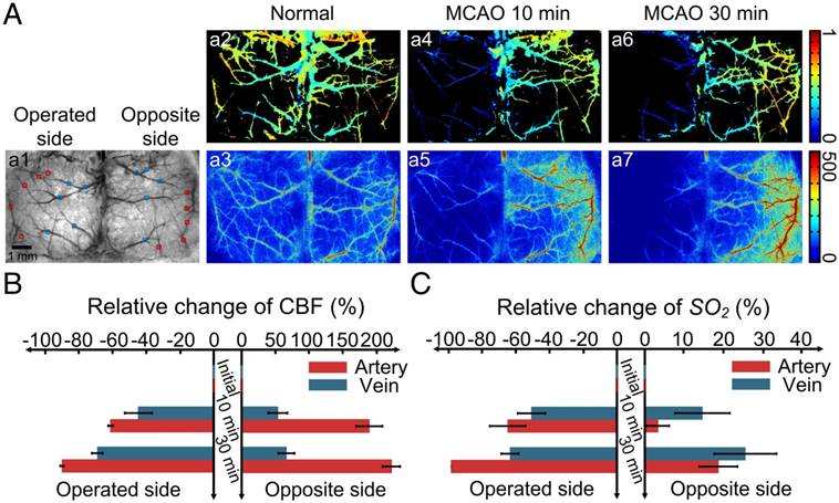 A large, switchable optical clearing skull window for cerebrovascular ...