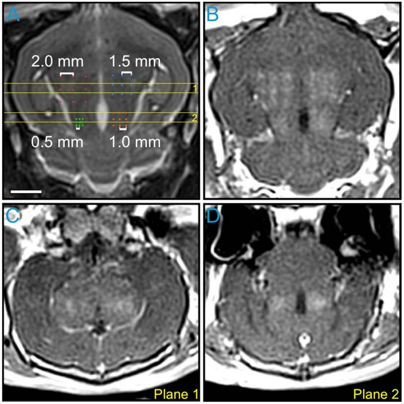 Three-dimensional transcranial microbubble imaging for guiding ...