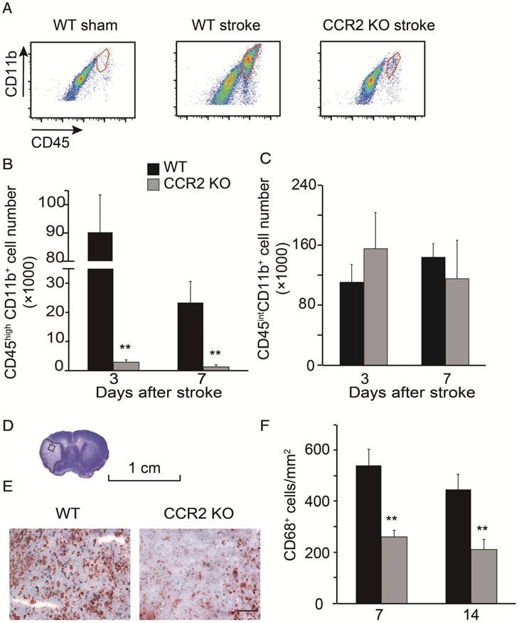 CCR2-dependent monocytes/macrophages exacerbate acute brain injury but ...